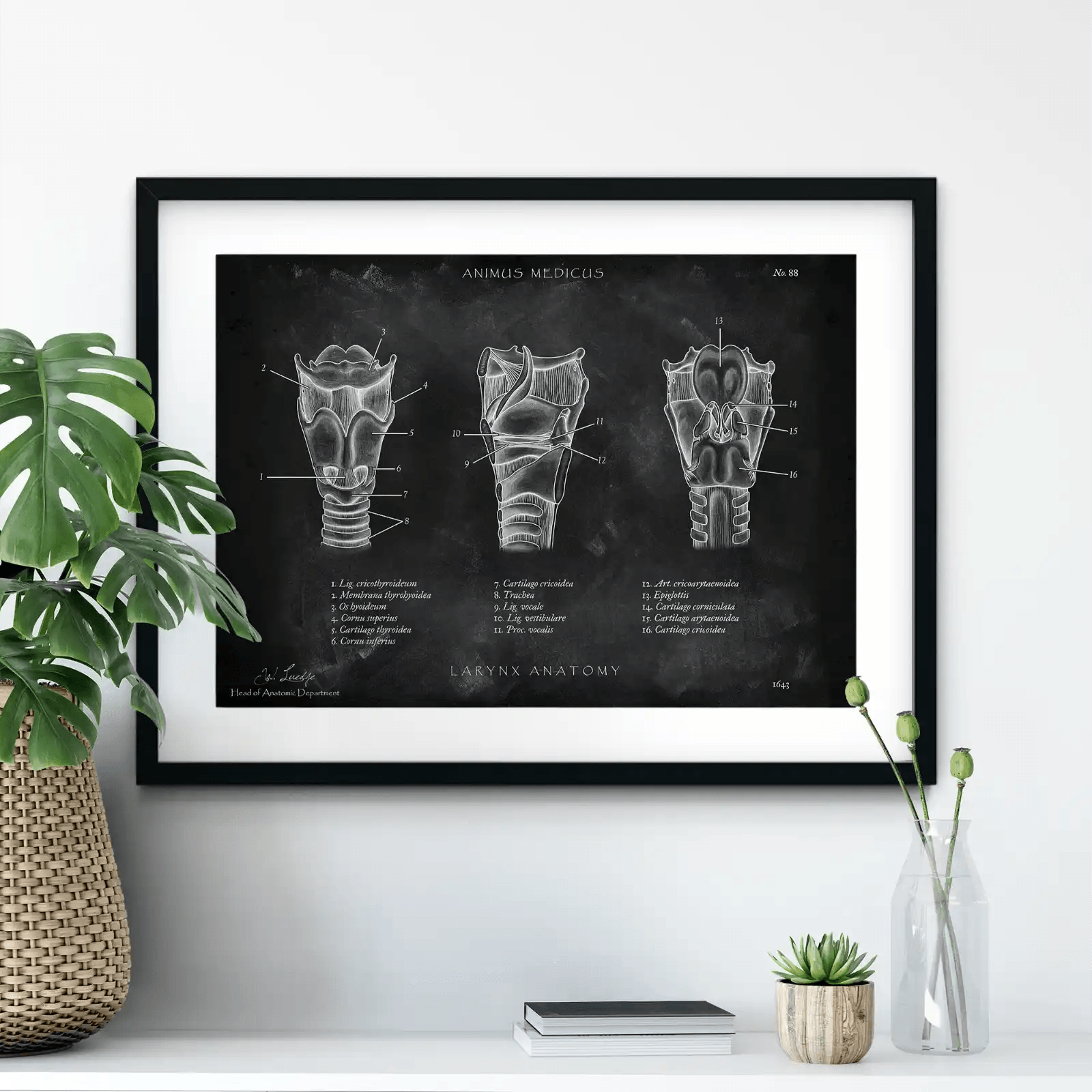 Kehlkopf Anatomie Poster - Animus Medicus – Animus Medicus GmbH